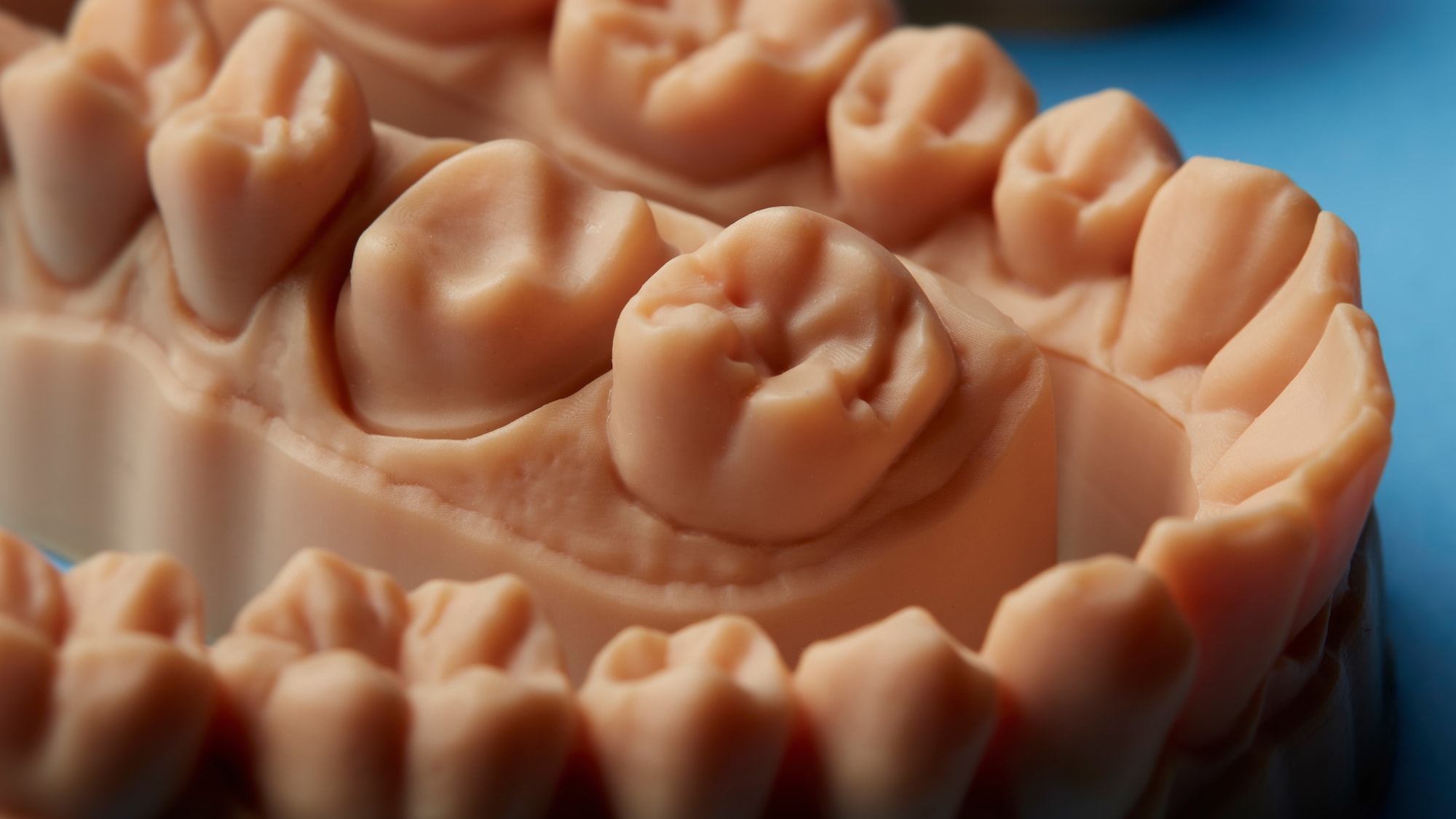 Print Dental Models 30% Faster on the Form 3B with Software Update ...