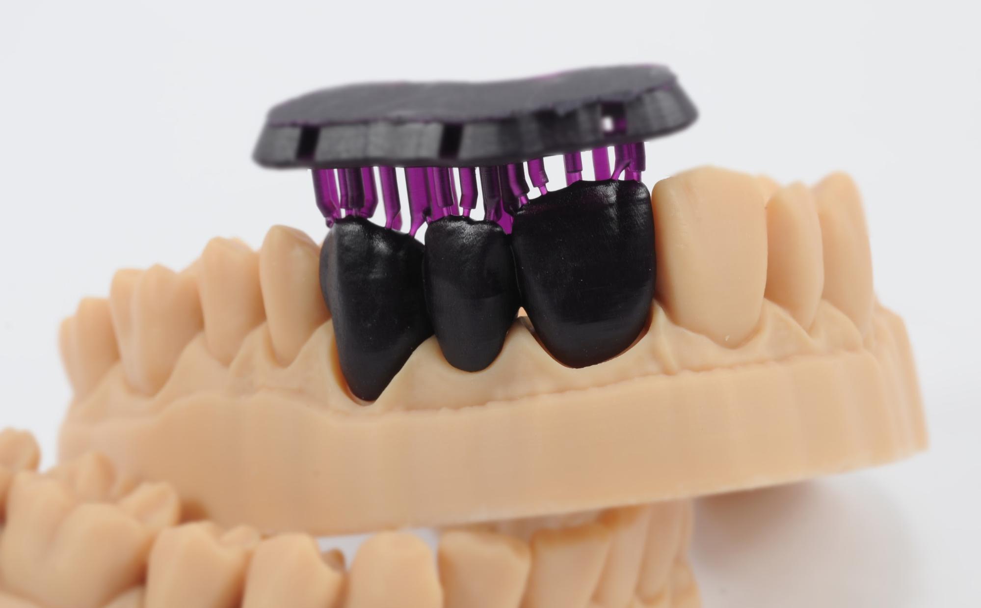 New Light-Touch Supports and Dental Settings for Castable Wax Resin in ...