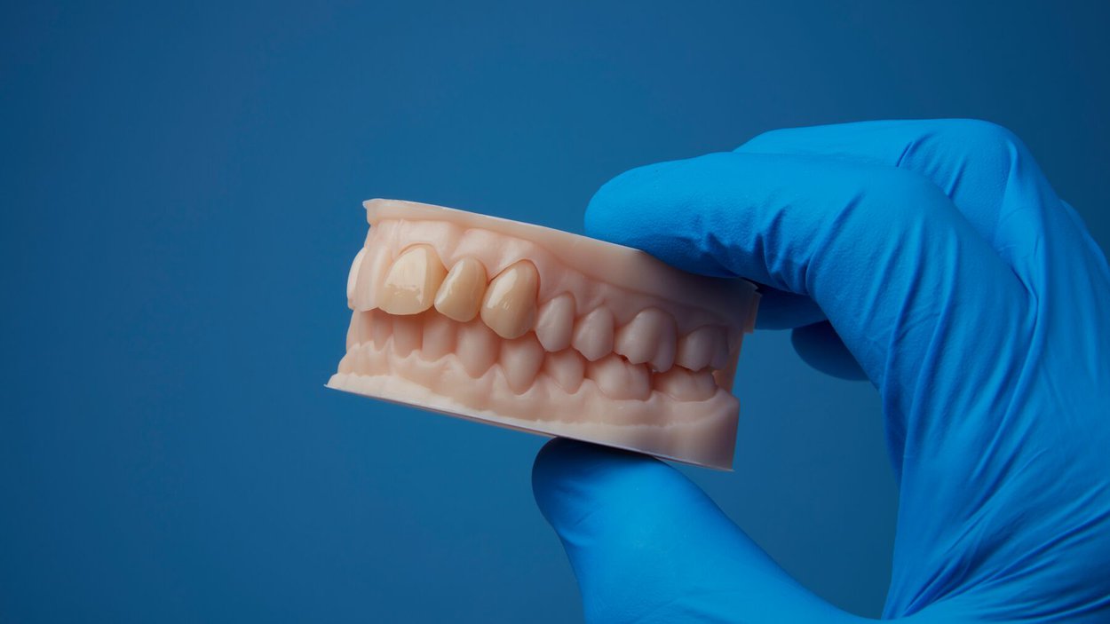 3D Printing for Dental Labs