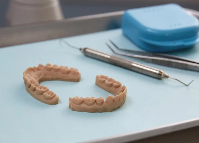3D Printing Dental Diagnostic Models | Formlabs Dental
