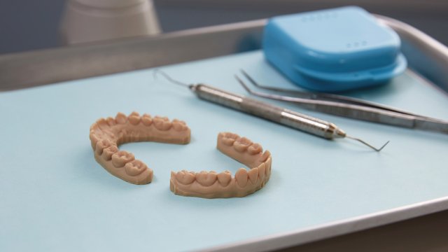 Application Guide: 3D Printing Diagnostic Models With Formlabs SLA 3D ...