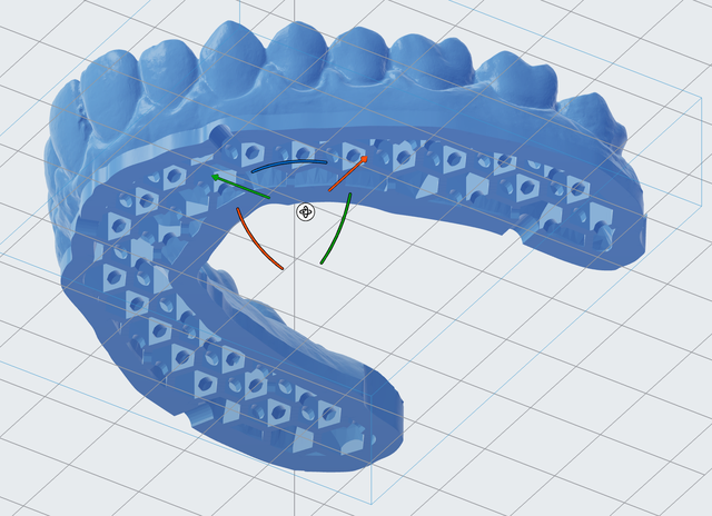 PreForm Dental 3.41.0: The Latest Software Updates Powering Efficiency ...