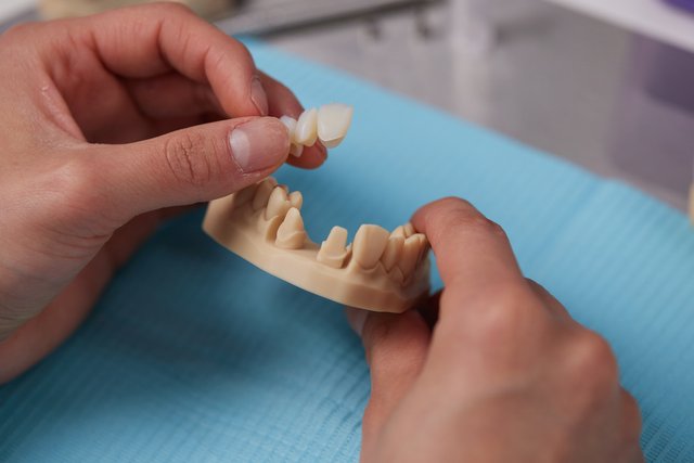 Precision Model Resin and Form 4B: Guide to Making the Most Accurate ...