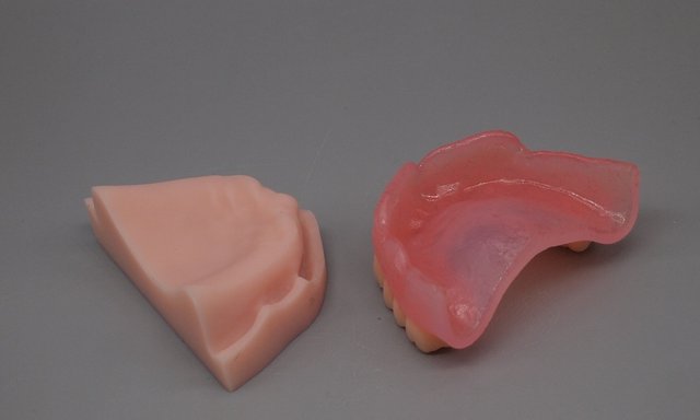 Relining of 3D Printed Dentures in Denture Base Resin from Formlabs ...