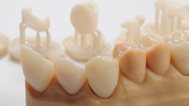 Application Guide: 3D Printing Permanent Crowns With the Form 3B ...