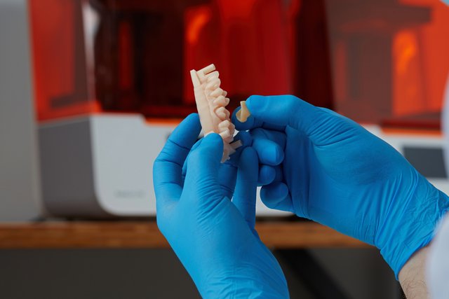 3D Printing Restorative Models | Formlabs Dental